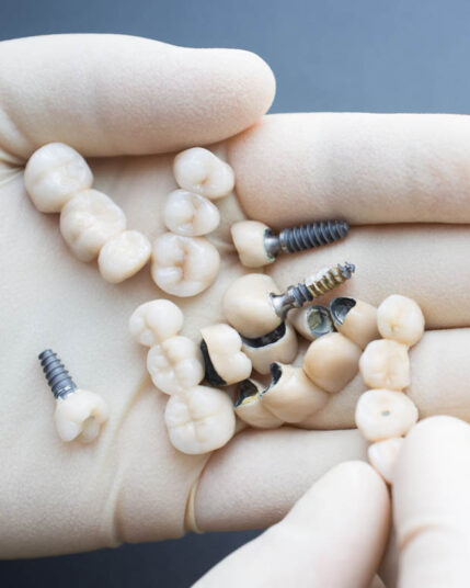 Dentist in Fairfax, VA | Local Dentist Fairfax Dental Center